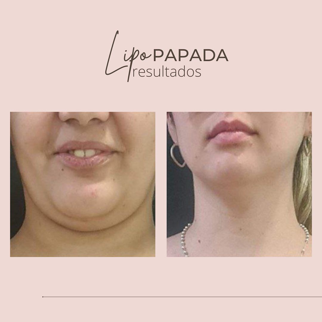 Dra. Paola León - Clinicasesteticas.com.co