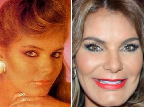 ¡TOP 5: Famosas colombianas más operadas !, Kari_Esteticas, oct 2017